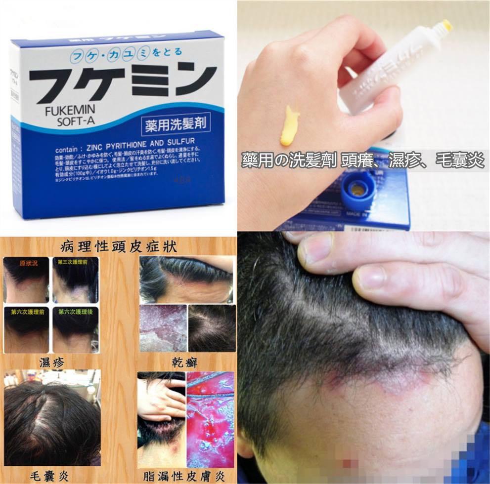 日本FUKEMIN去頭皮止痕藥用洗髮養髮劑, 美容＆化妝品, 沐浴＆身體護理, 沐浴及身體護理 - 身體護理 - Carousell