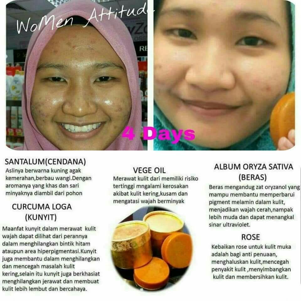 Susuk Emas Gold Soap for Men & Women, Health & Nutrition, Health ...