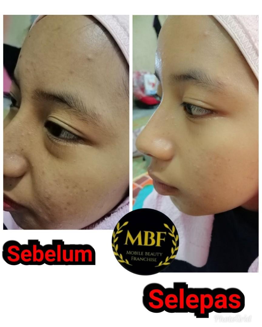 Rawatan muka, Beauty & Personal Care, Face, Face Care on Carousell