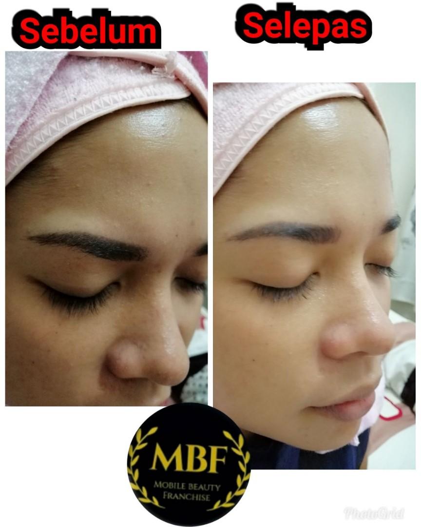 Rawatan muka, Beauty & Personal Care, Face, Face Care on Carousell