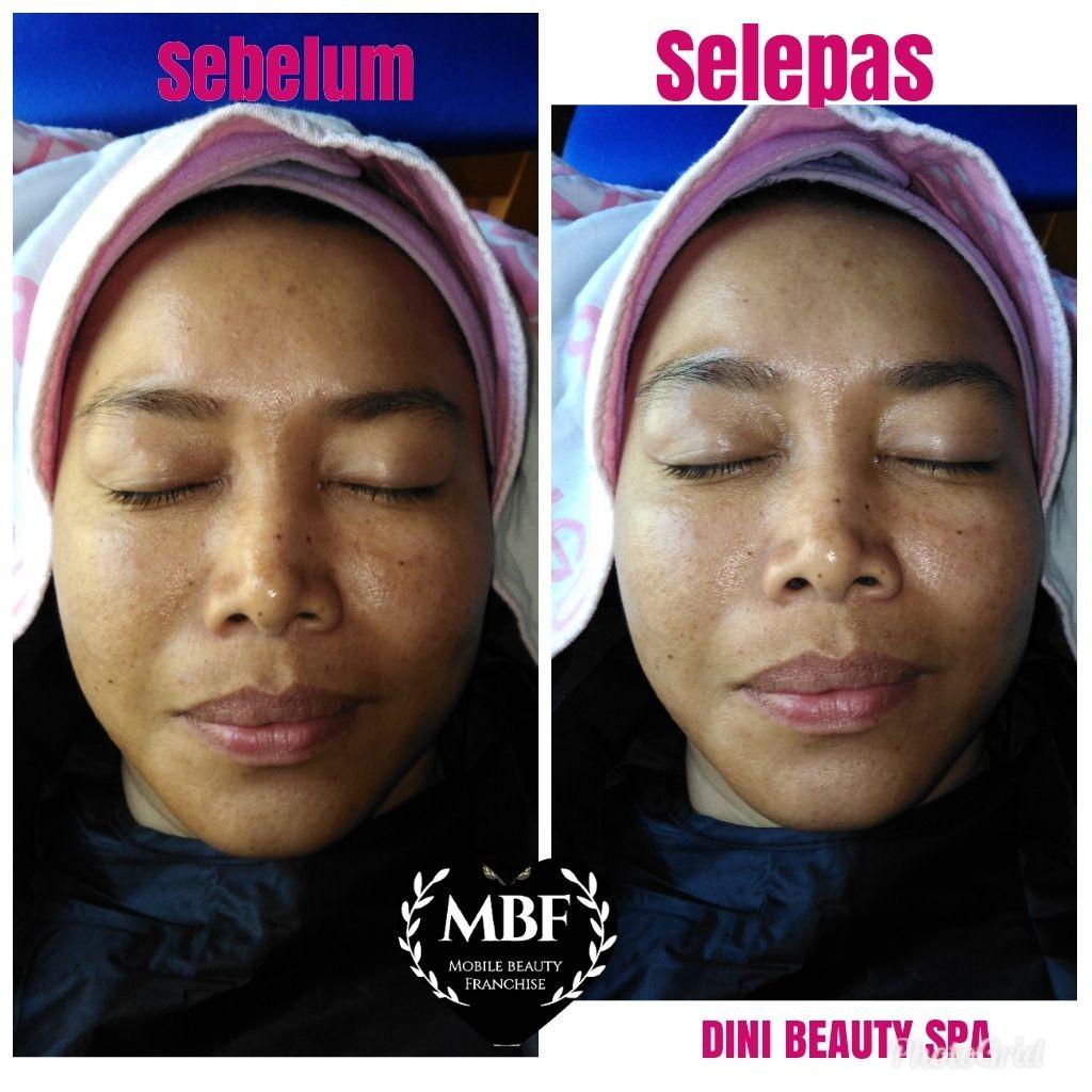 Rawatan muka, Beauty & Personal Care, Face, Face Care on Carousell