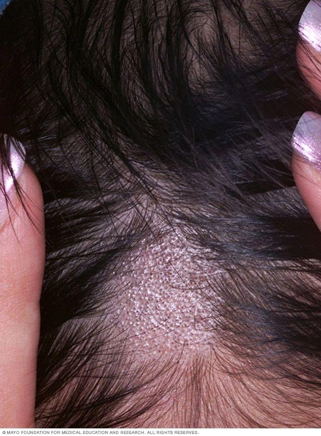 Organic hair scrap treatment, Beauty & Personal Care, Hair on Carousell