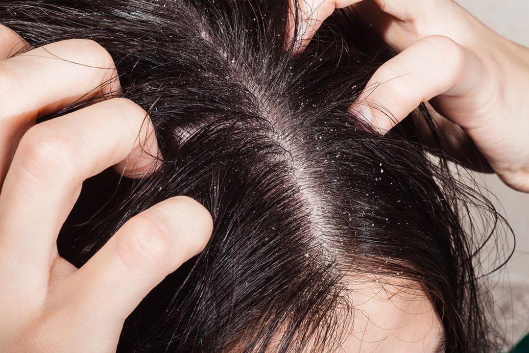 Organic hair scrap treatment, Beauty & Personal Care, Hair on Carousell
