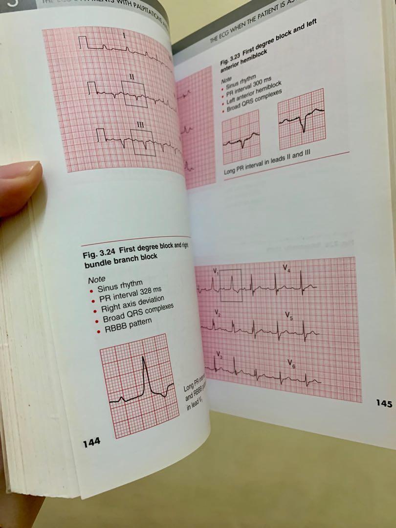 ECG made easy, Hobbies & Toys, Books & Magazines, Children's Books on ...