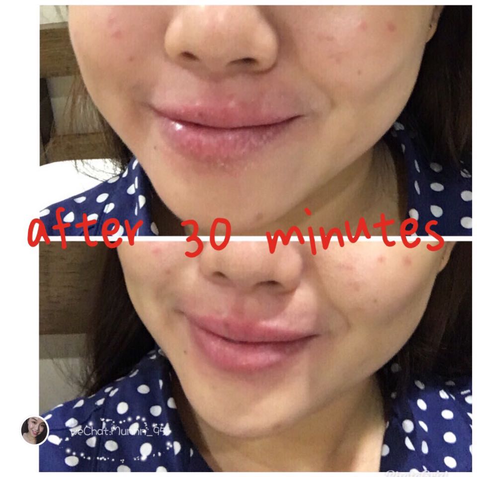 Skin dryness solution - Dilina Collagen Oxygen Mask (5pcs）, Beauty ...