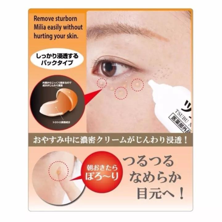 $25 Tsubu Night Pack - Milia (Oil Bumps) Remover, Beauty & Personal ...