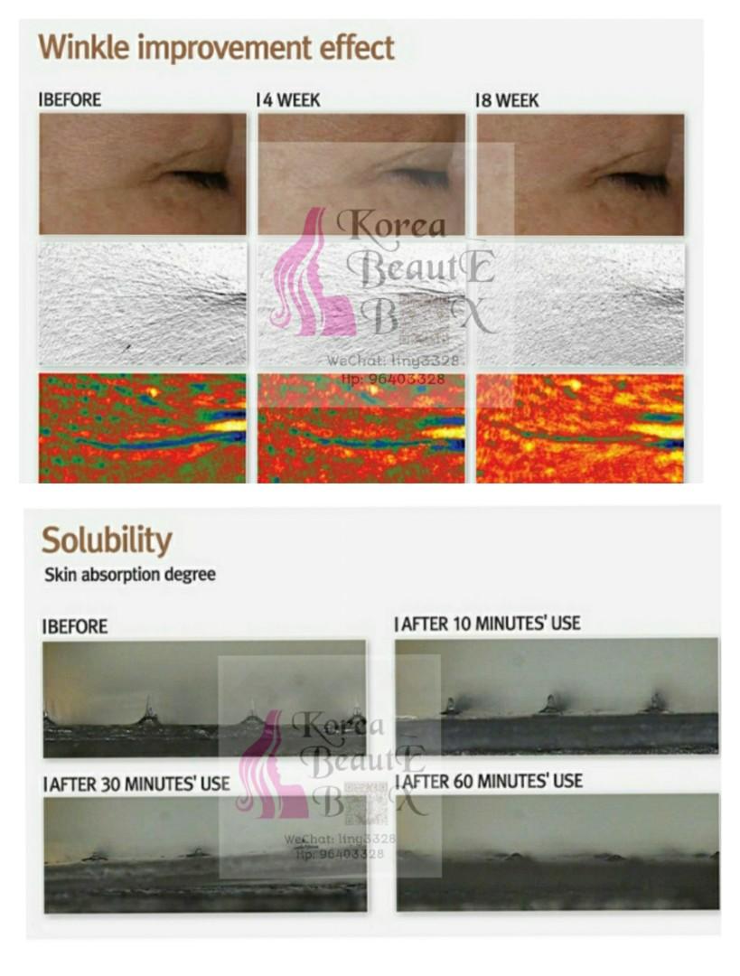 ROYAL SKIN Micro Patch (Eye & Laugh Lines) [4 Pack/4Pairs], Beauty ...