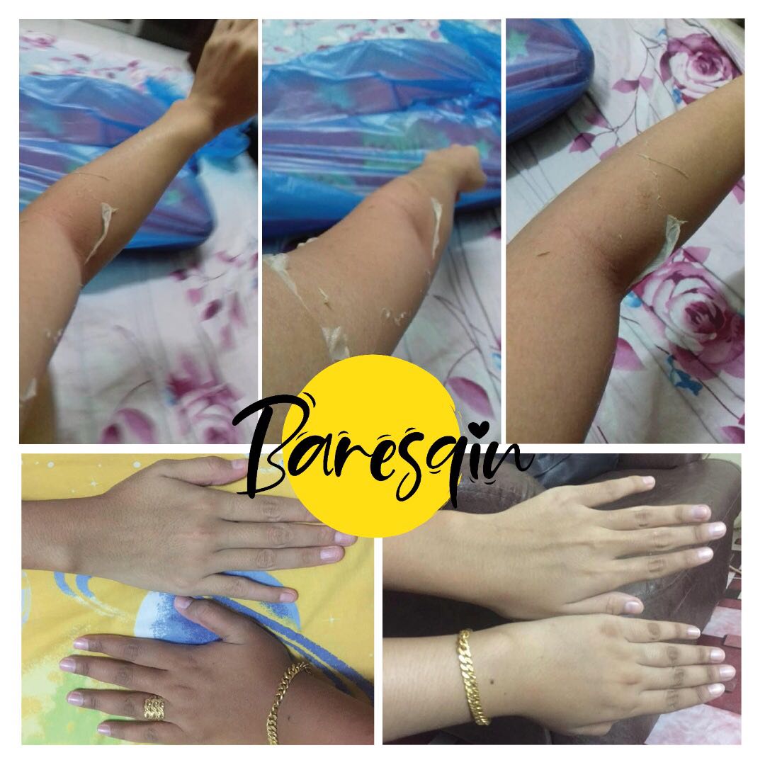 Skin whitening injection, Beauty & Personal Care, Bath & Body, Body ...