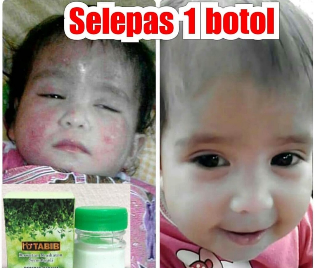 Krim Herba Rerama on Carousell