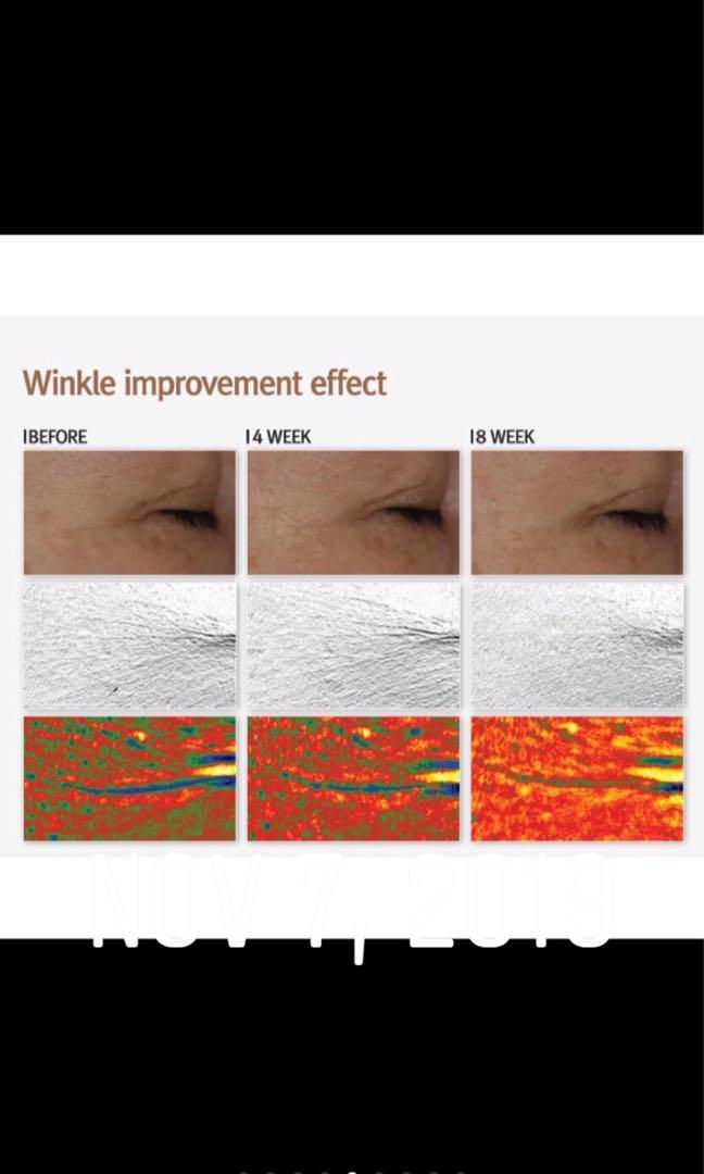 Royal skin micro eye patch, Beauty & Personal Care, Face, Face Care on ...