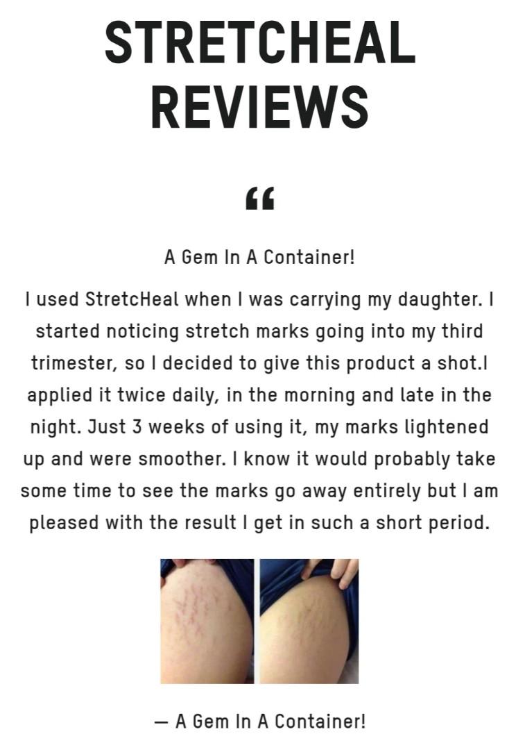 *FREE SMARTPAC* Stretcheal Stretch Mark Cream, Beauty & Personal Care ...