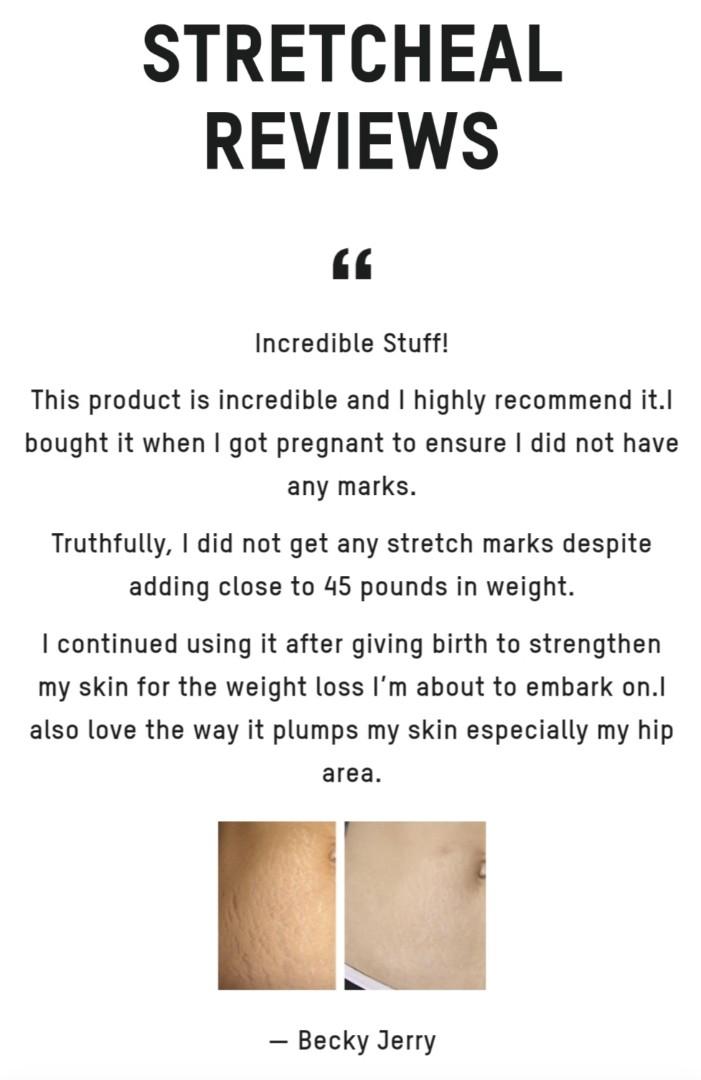 *FREE SMARTPAC* Stretcheal Stretch Mark Cream, Beauty & Personal Care ...