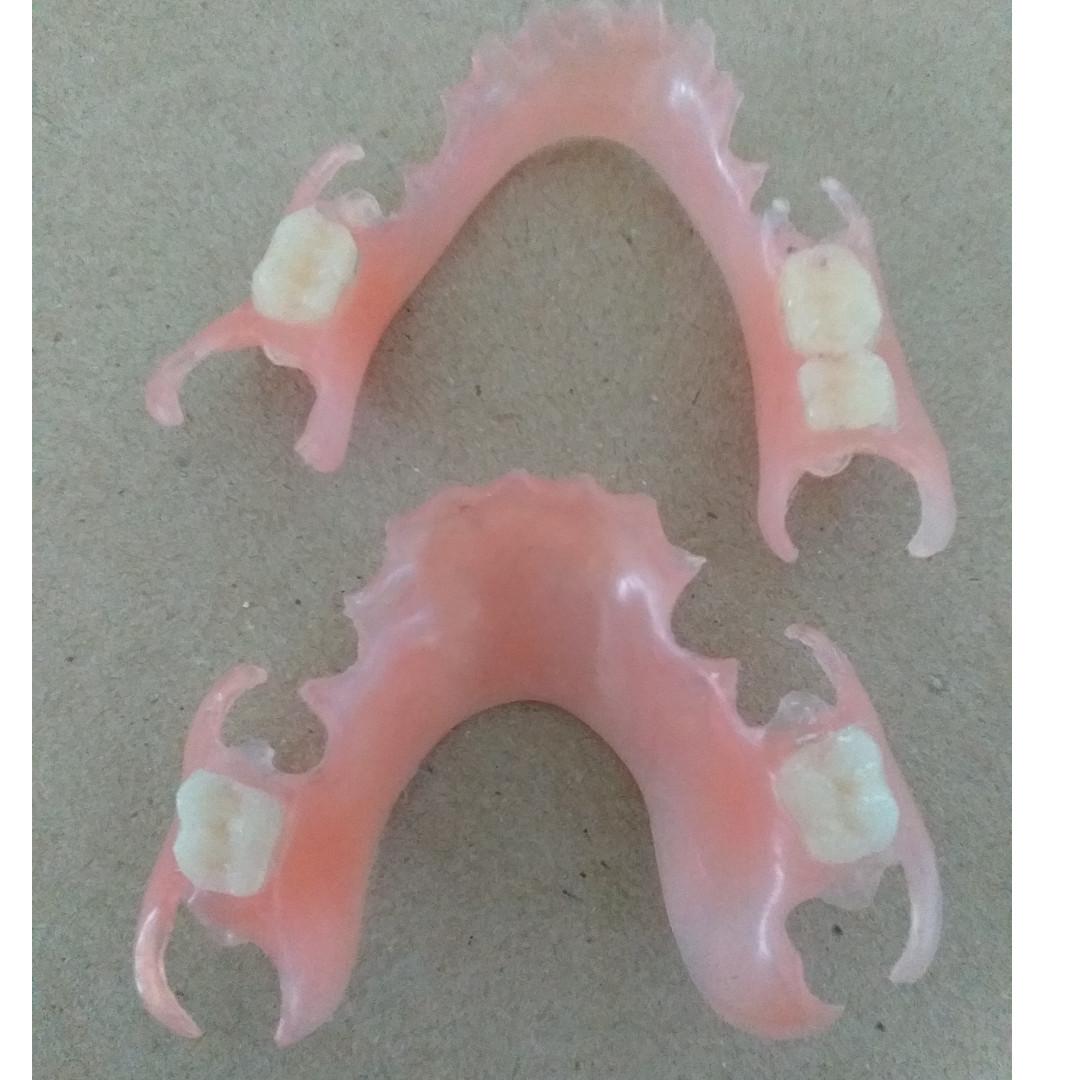 Flexible Denture Pustiso Fixed Bridge E-max Zirconia Jacket Crown ...
