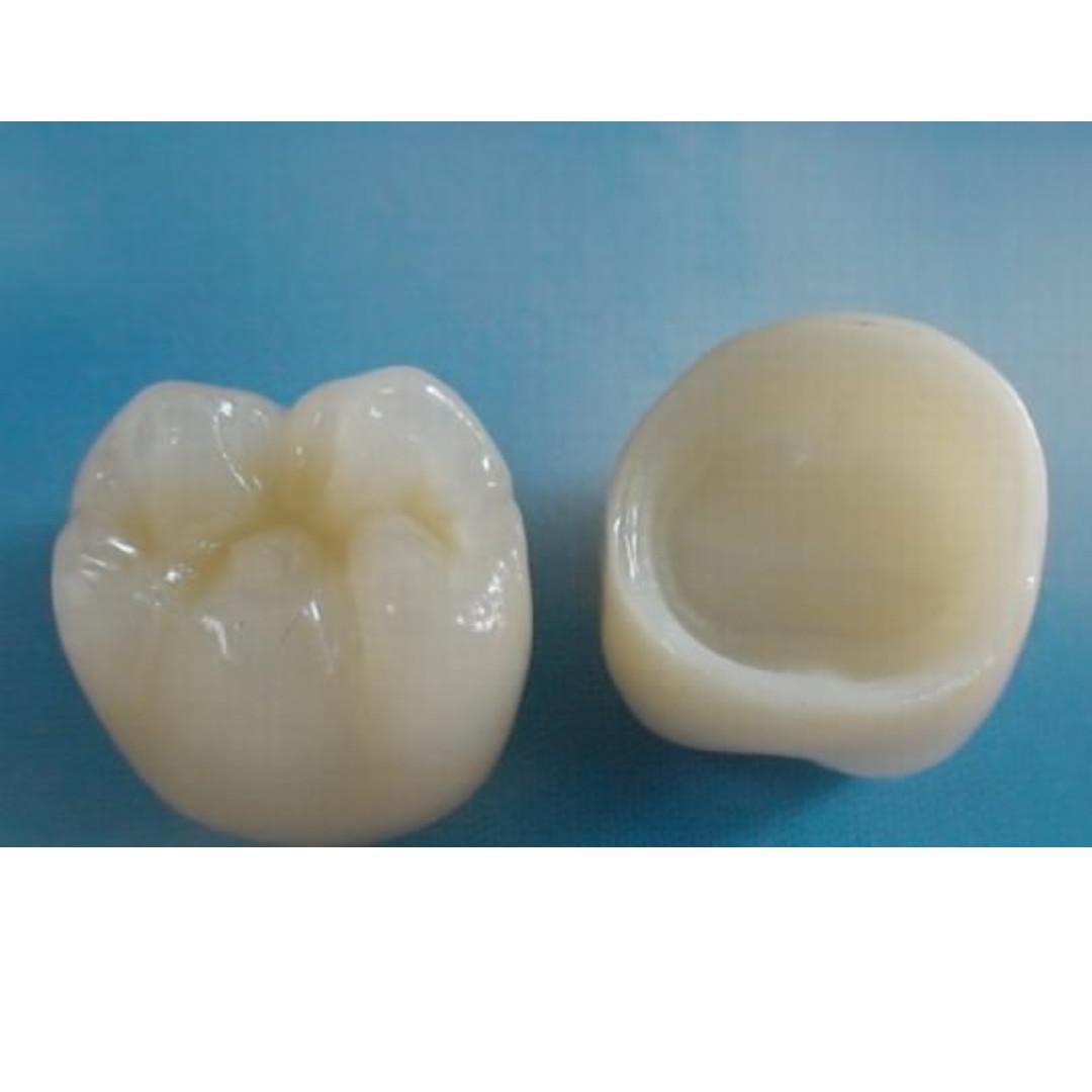 Flexible Denture Pustiso Fixed Bridge E-max Zirconia Jacket Crown ...