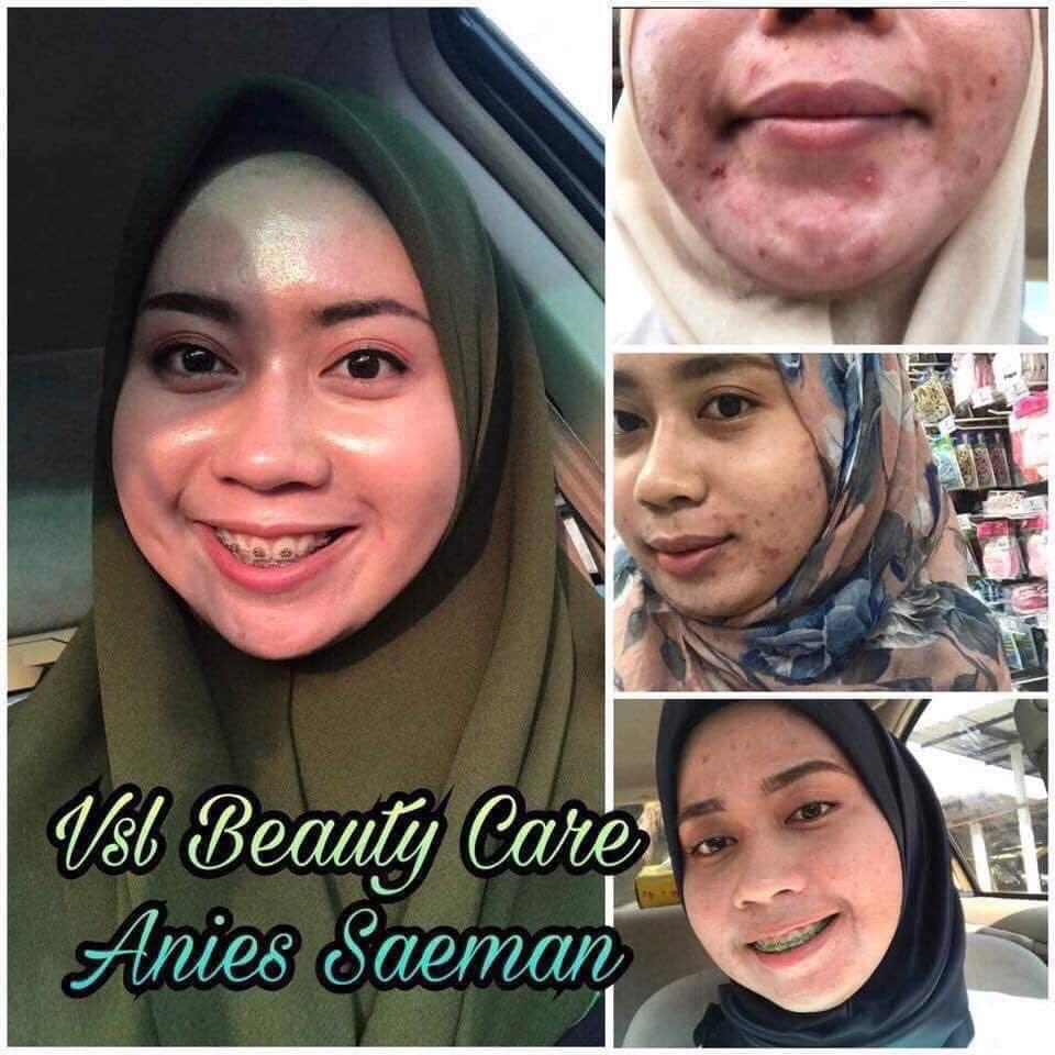 Vsl skincare pelbagai set, Health & Beauty, Face & Skin Care on Carousell