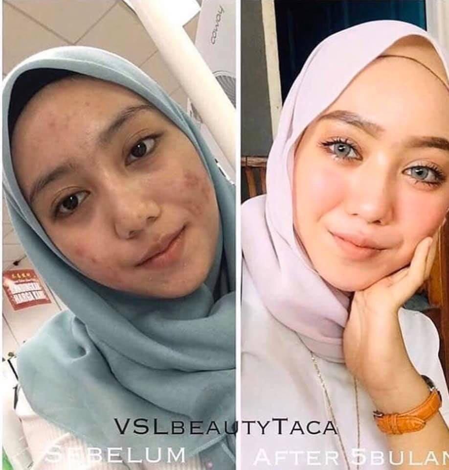 Vsl skincare pelbagai set, Health & Beauty, Face & Skin Care on Carousell