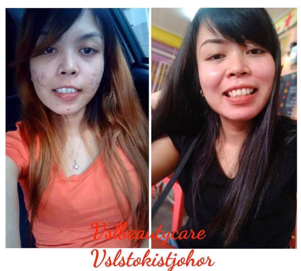 Vsl skincare pelbagai set, Health & Beauty, Face & Skin Care on Carousell