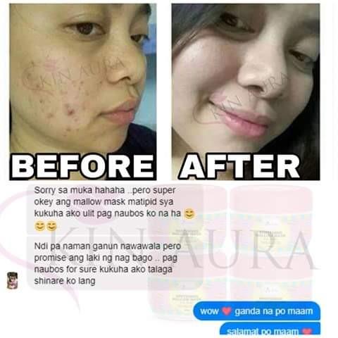 Skin aura whitening mallow mask and Tomae serum, Beauty & Personal Care ...