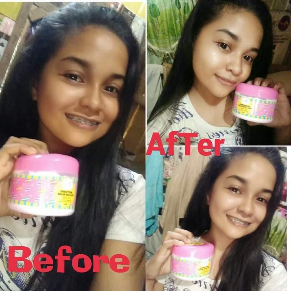 Skin aura whitening mallow mask and Tomae serum, Beauty & Personal Care ...