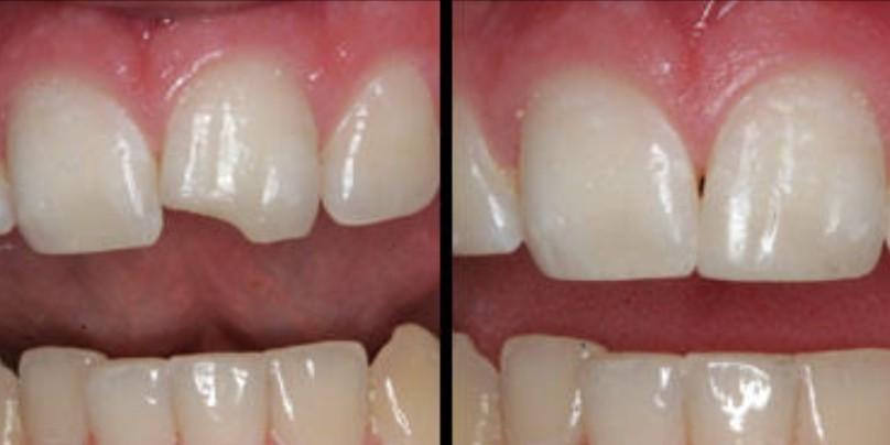 Teeth restoration, extraction, jacket crown, scaling cleaning, brackets ...