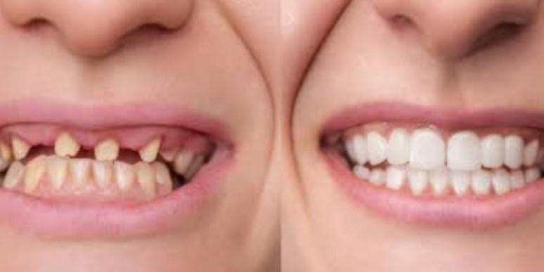 Teeth restoration, extraction, jacket crown, scaling cleaning, brackets ...