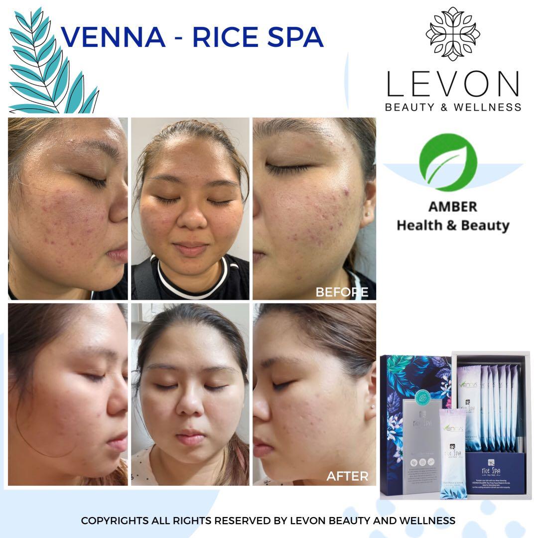 Venna Rice Spa, Beauty & Personal Care, Face, Face Care on Carousell