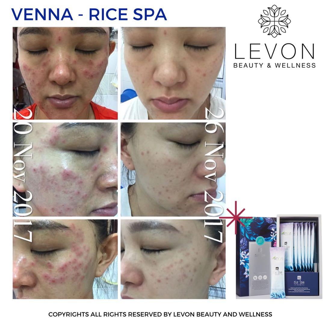 Venna Rice Spa, Beauty & Personal Care, Face, Face Care on Carousell