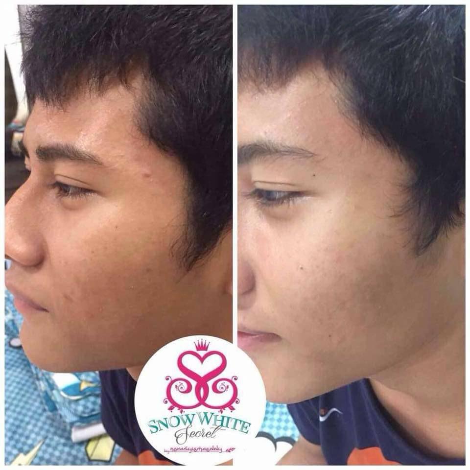 SNOW WHITE CHEWABLE TABLETS / JAMU SNOW WHITE, Health & Nutrition ...