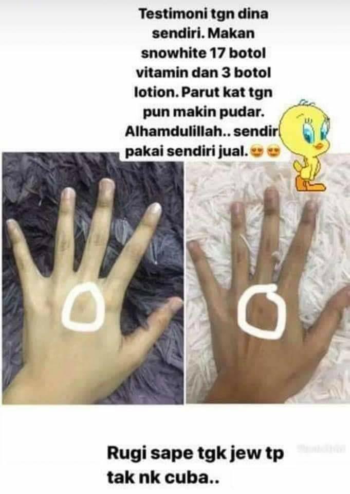 SNOW WHITE CHEWABLE TABLETS / JAMU SNOW WHITE, Health & Nutrition ...