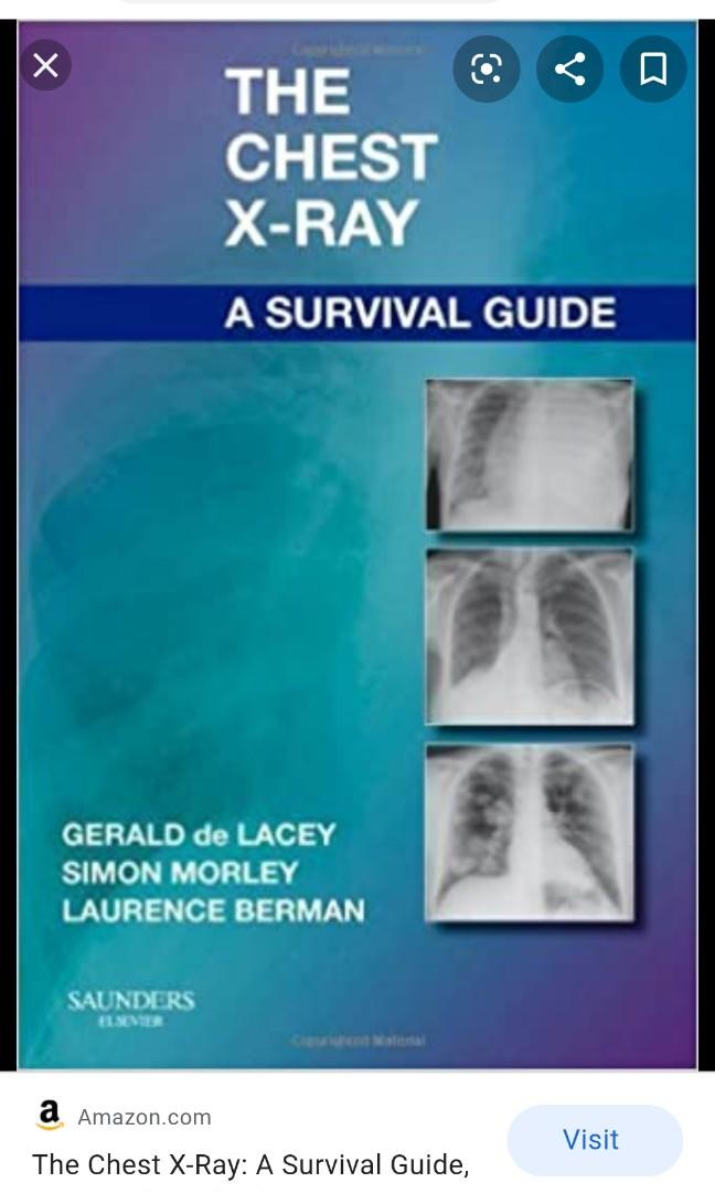 The chest xray a survival guide Gerald de lacey, Hobbies & Toys, Books ...