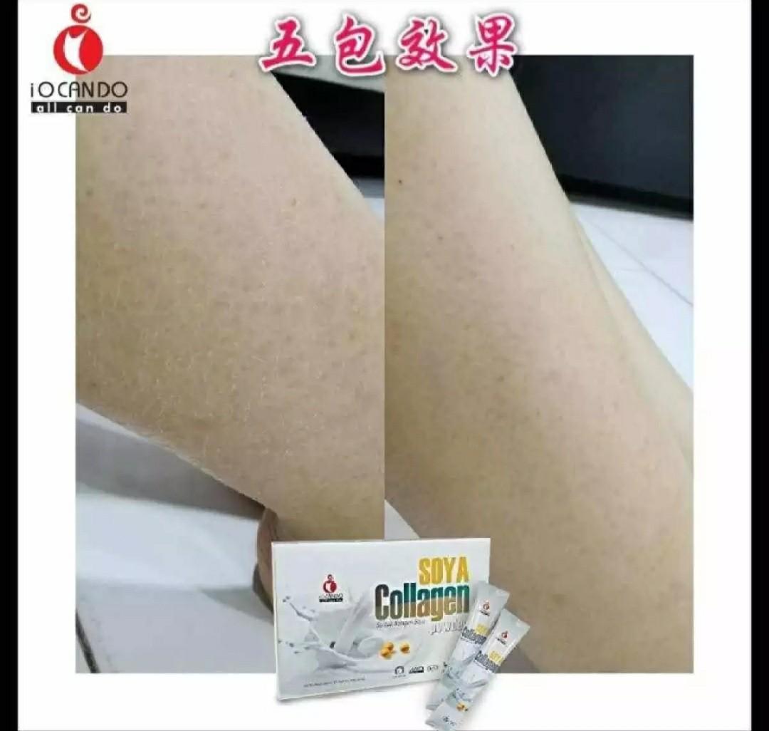 iOCANDO Soya Collagen (Last Box to go!), Health & Nutrition, Health Supplements, Health Food ...