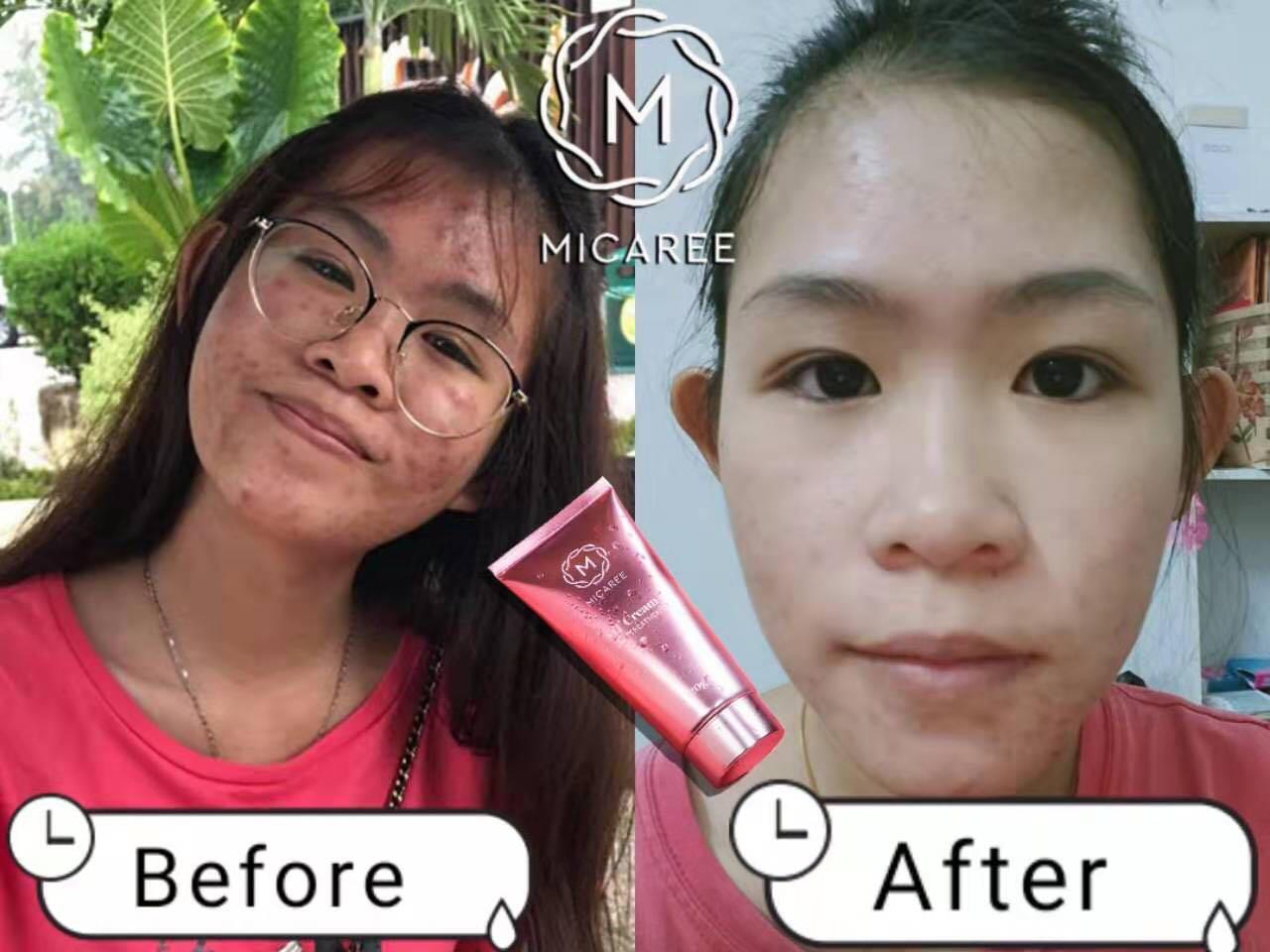 Micaree OT Cream 养白霜, Beauty & Personal Care, Face, Face Care on Carousell