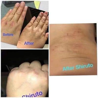 Shiruto Vitamin of Immunity 1 box 30’s, Health & Nutrition, Health ...