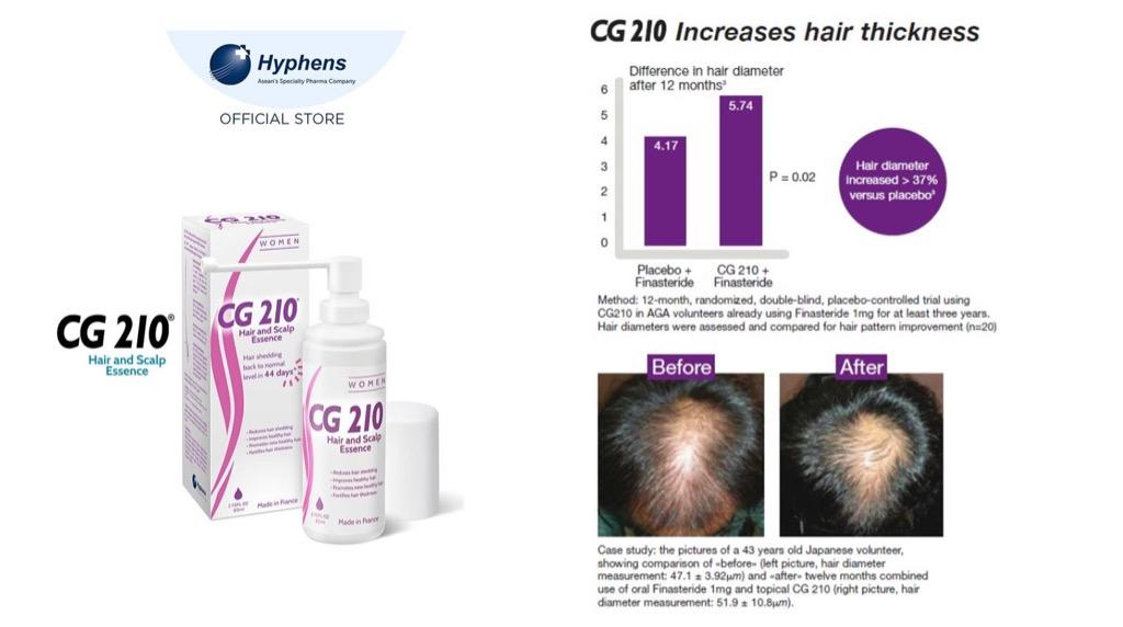 Hyphens Pharma CG210 Hair and Scalp Essence, Beauty & Personal Care ...