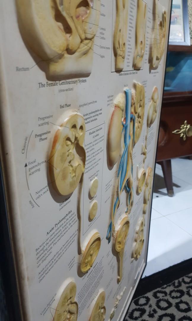 Vintage Anatomy Chart The Urinary Tract, Men's Fashion, Watches ...