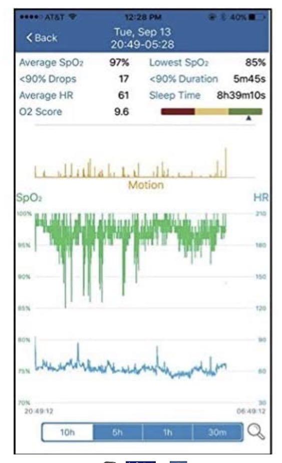BodiMetrics O2 Vibe Sleep & Fitness Monitor - Oxygen & Heart Rate ...