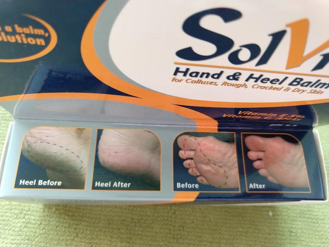 Solvit Hand & Heel Balm 75g, Beauty & Personal Care, Foot Care on Carousell