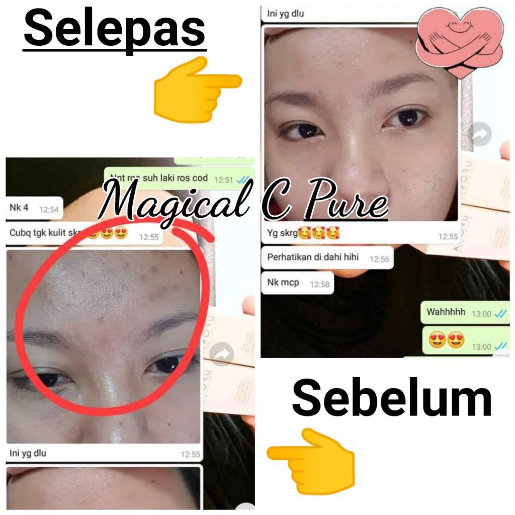 Magical C Pure MCP on Carousell
