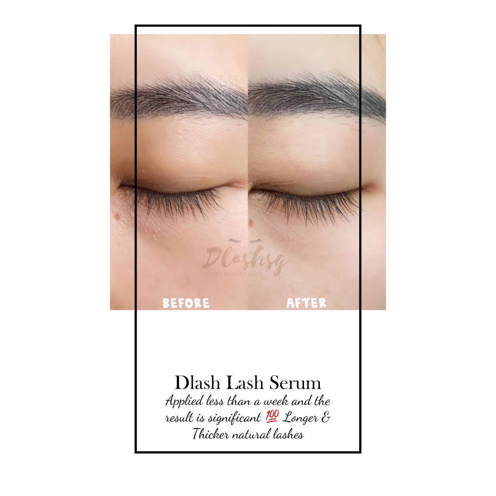 Dlash Eyelash Serum, Beauty & Personal Care, Face, Makeup on Carousell