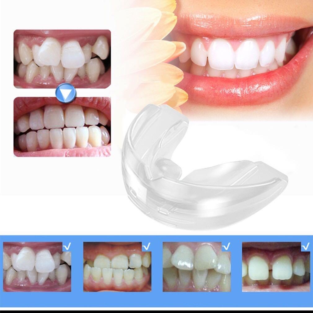 Teeth Retainer Teens Adults Teeth Retainer Dental Health Care Straight ...