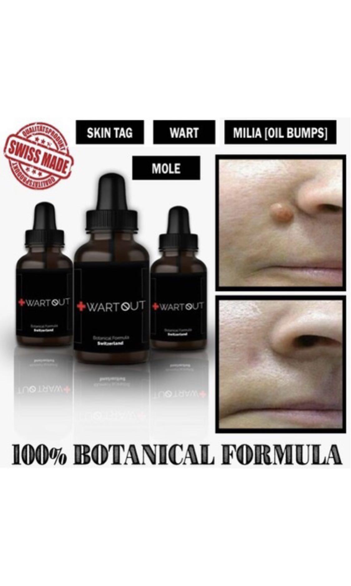 WART / MOLE / SKIN TAG / OIL BUMPS (MILIA SEED) REMOVER 100% botanical ...