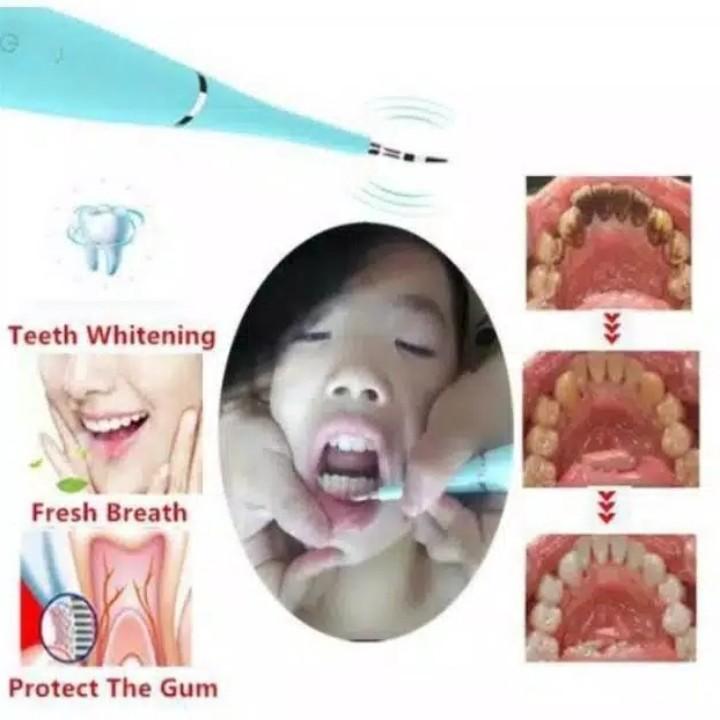 ALAT PEMBERSIH KARANG GIGI DENTAL SCALER ELEKTRIK, Kesehatan ...