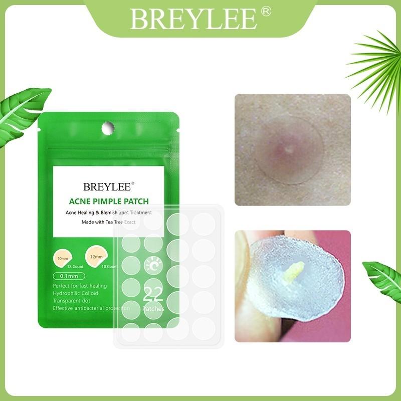 BREYLEE Acne Pimple Patch, Beauty & Personal Care, Face, Face Care on ...