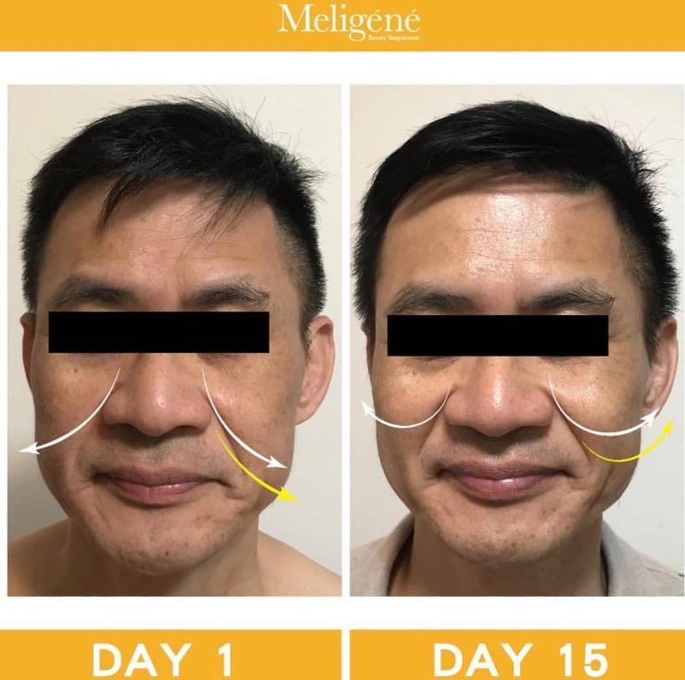 Meligene Skin Food, Health & Nutrition, Health Supplements, Health Food ...