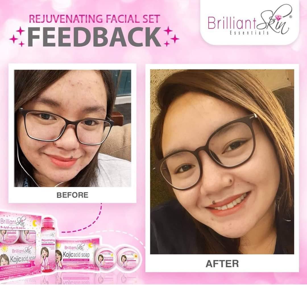 Brilliant Skin Rejuvenating Set, Beauty & Personal Care, Face, Face ...