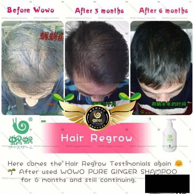 Wowo Ginger Shampoo (Authentic w/QR code), Beauty & Personal Care, Hair ...