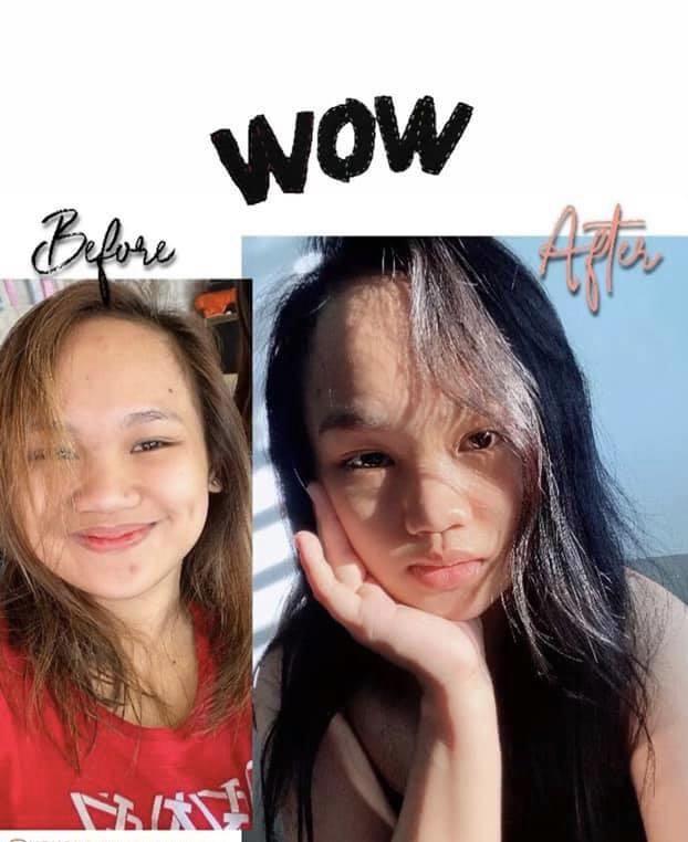 You Glow Babe Set Beauty Personal Care Face Face Care On Carousell