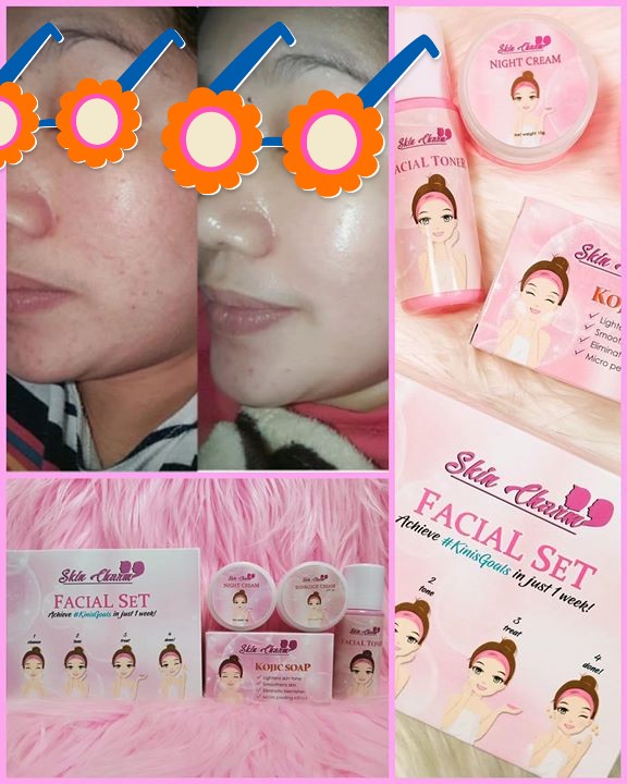 Skin Charm Facial Set, Beauty & Personal Care, Face, Face Care on Carousell
