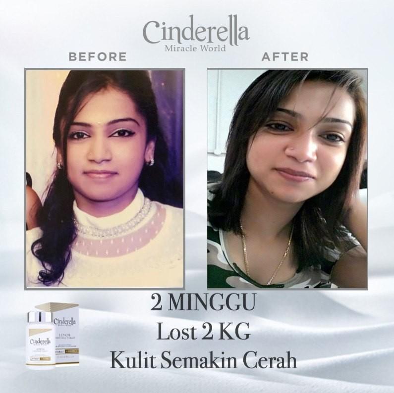 Cinderella (CGS) chewable tablet, Health & Beauty, Face & Skin Care on ...