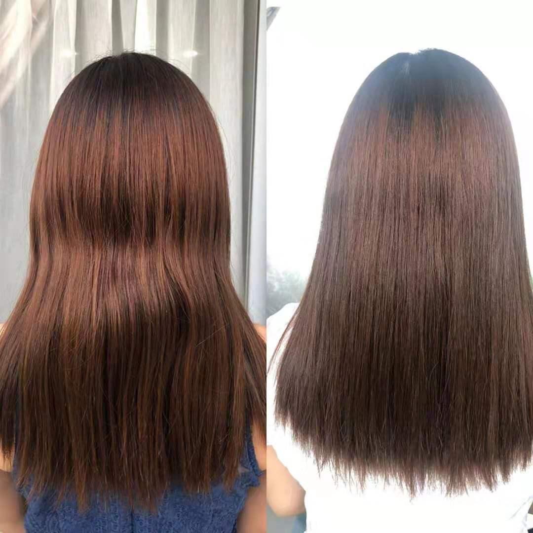 US Hair loss treatment product, Beauty & Personal Care, Hair on Carousell